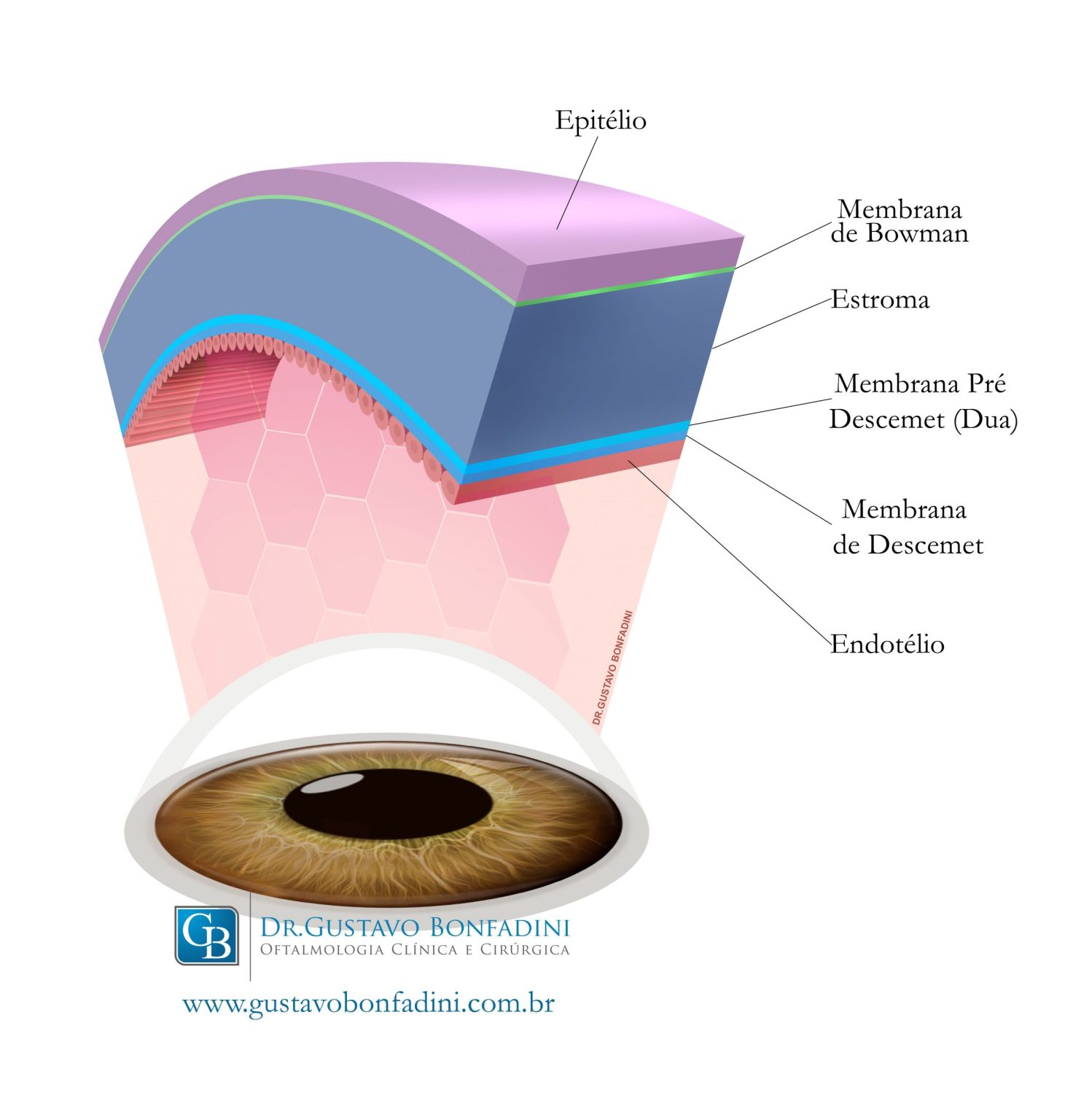 Transplante Endotelial de Córnea – Gustavo Bonfadini